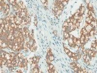 VENTANA® anti-BRAF V600E (VE1) Mouse Monoclonal Primary Antibody, For ...