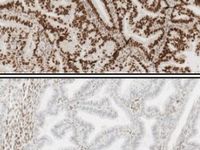 VENTANA® anti-MSH2 (G219-1129) Mouse Monoclonal Primary Antibody, For ...