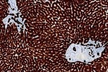 BenchMark Special Stains AFB Staining Kit