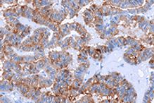 VENTANA® anti-MSH2 (G219-1129) Mouse Monoclonal Primary Antibody, For ...