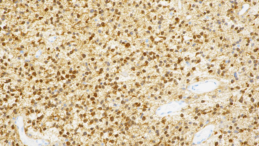 IDH1 R132H (MRQ-67) CM Rabbit Monoclonal Antibody