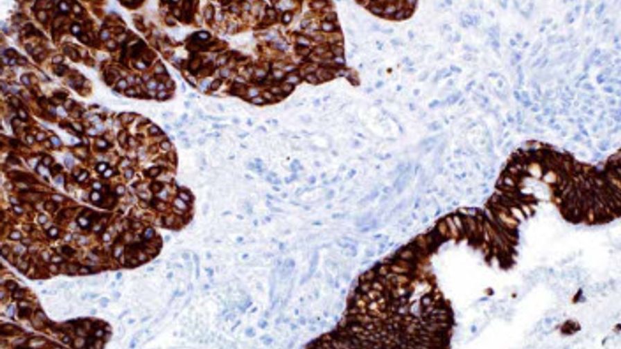 Cytokeratin (OSCAR) Mouse Monoclonal Antibody