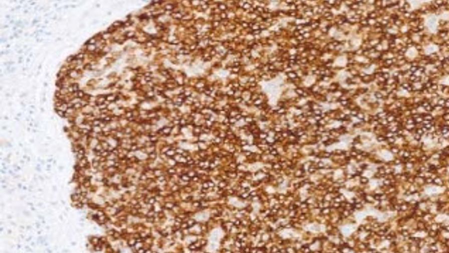 anti-CD30 (Ber-H2) Mouse Monoclonal Primary Antibody