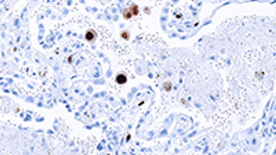 anti-CMV Blend (8B1.2, 1G5.2 & 2D4.2) Mouse Monoclonal Primary Antibody ...