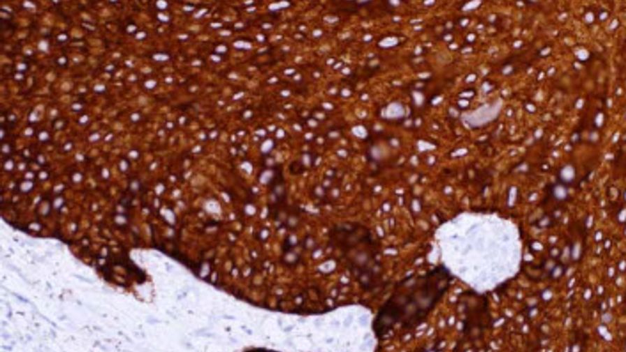 anti-Cytokeratin 14 (SP53) Rabbit Monoclonal Primary Antibody