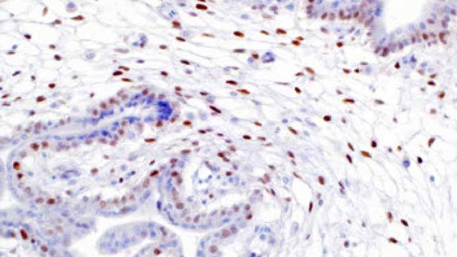 anti-p57Kip2 (Kp10) Mouse Monoclonal Primary Antibody