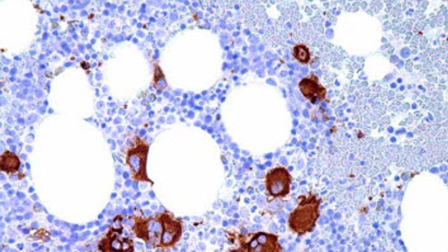 CD61 (2f2) Mouse Monoclonal Antibody