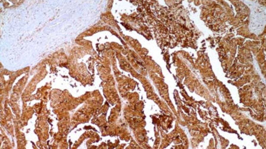 CEA (CEA31) Mouse Monoclonal Antibody