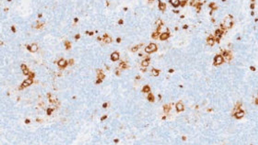 CONFIRM anti-CD15 (MMA) Mouse Monoclonal, Primary Antibody