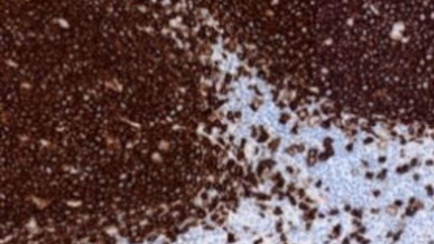 CONFIRM anti-CD20 (L26) Primary Antibody