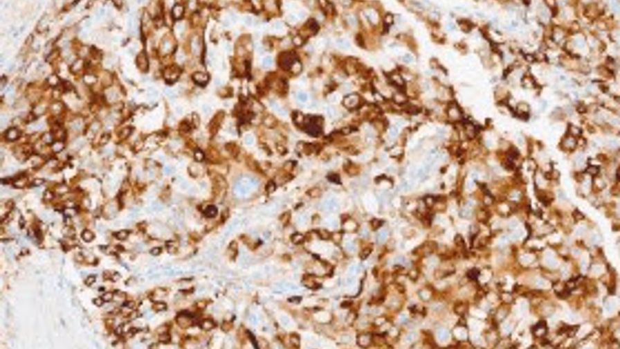 CONFIRM anti-EMA (E29) Mouse Monoclonal Primary Antibody