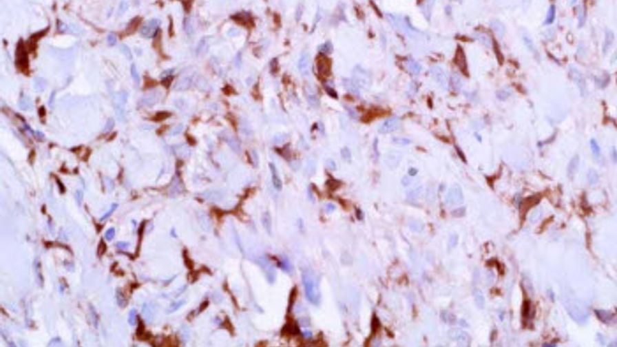 Factor XIIIa (AC-1A1) Mouse Monoclonal Antibody