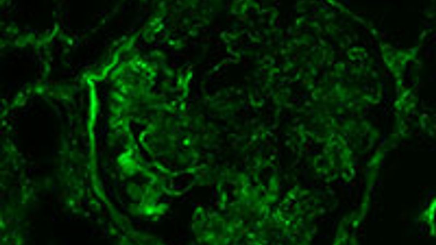 FITC Anti-C1q Primary Antibody