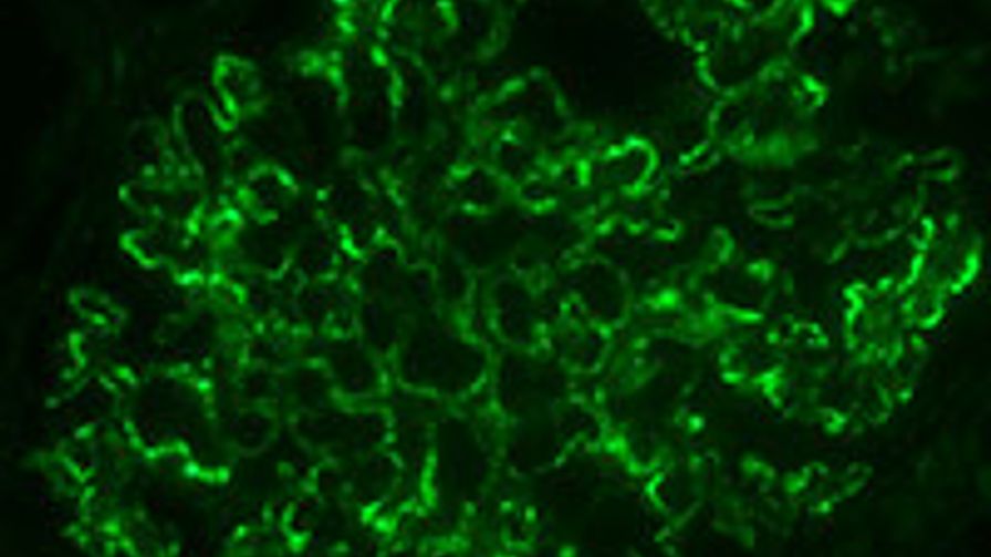FITC Anti-IgM Primary Antibody