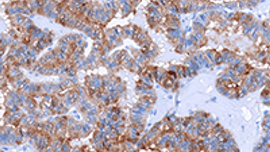 Galectin-3 (9C4) Mouse Monoclonal Antibody