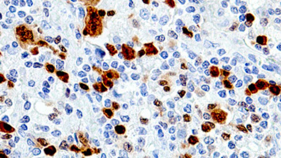 MUM1 (EP190) Rabbit Monoclonal Antibody