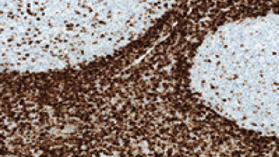 OptiView Amplification Kit