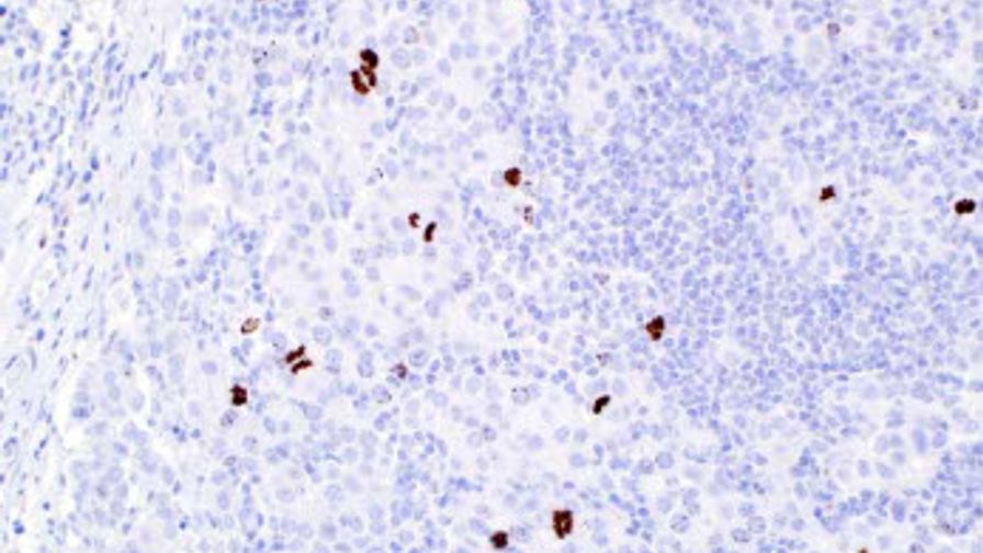 Phosphohistone H3 (PHH3) Rabbit Polyclonal Antibody