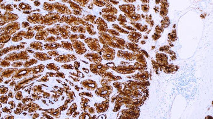 PSMA (EP192) Rabbit Monoclonal Primary Antibody