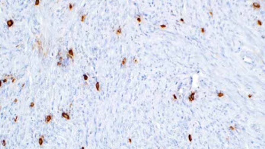 Tryptase (G3) Mouse Monoclonal Antibody