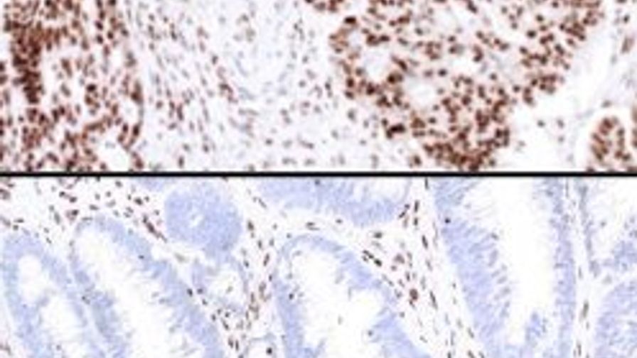 VENTANA® anti-MLH1 (M1) Mouse Monoclonal Primary Antibody, For use with ...