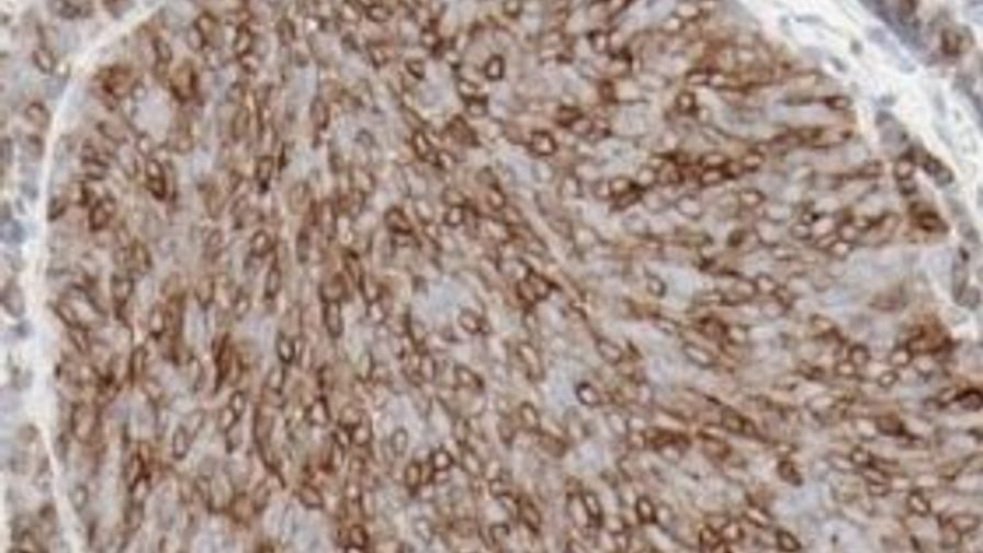 VENTANA® DLL3 (SP347) Assay