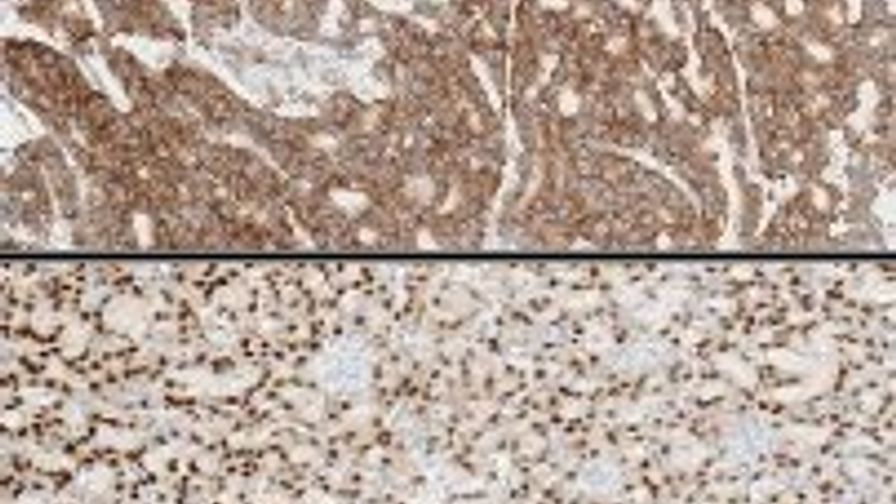 VENTANA® pan-TRK (EPR17341) Assay