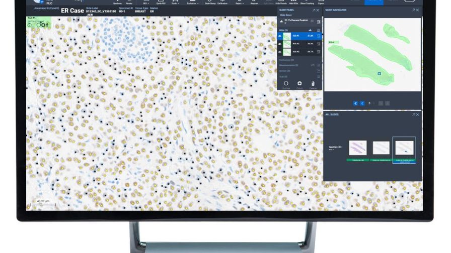 uPath ER (SP1) image analysis, Breast