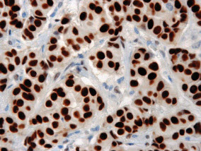 CONFIRM anti-Estrogen Receptor (ER) (SP1) Rabbit Monoclonal Primary ...