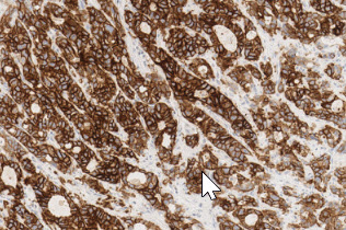 VENTANA® FGFR2b (FPR2-D) Mouse Monoclonal Antibody