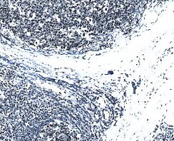 VENTANA® U6 BF Probe