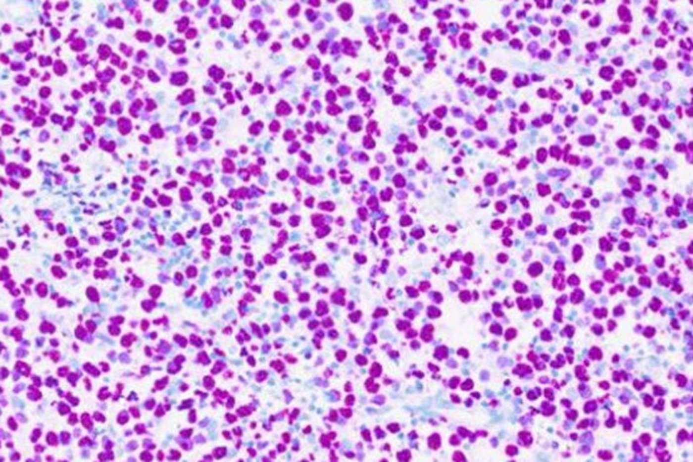 VENTANA® EBER Probe