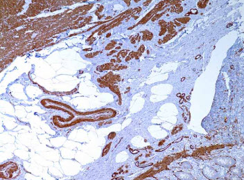 Actin, Smooth Muscle (1A4) Mouse Monoclonal Antibody