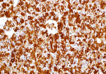 VENTANA PD-L1 (SP263) Rabbit Monoclonal Primary Antibody