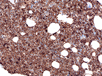 Annexin A1 (MRQ-3) Mouse Monoclonal Antibody