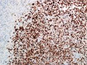 anti-ALK (D5F3) Rabbit Monoclonal Primary Antibody