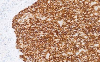 anti-CD30 (Ber-H2) Mouse Monoclonal Primary Antibody