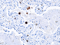 anti-CMV Blend (8B1.2, 1G5.2 & 2D4.2) Mouse Monoclonal Primary Antibody ...