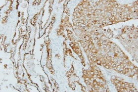 anti-MUC1 (H23) Mouse Monoclonal Primary Antibody