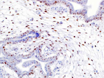 anti-p57Kip2 (Kp10) Mouse Monoclonal Primary Antibody
