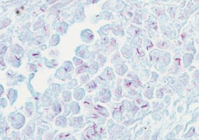 BenchMark Special Stains AFB Staining Kit