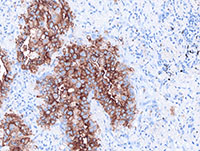 BG8, Lewisy (F3) Mouse Monoclonal Antibody