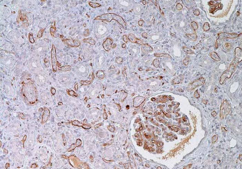 C3d Rabbit Polyclonal Antibody