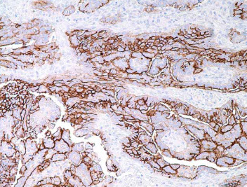 CA-125 (OC125) Mouse Monoclonal Antibody