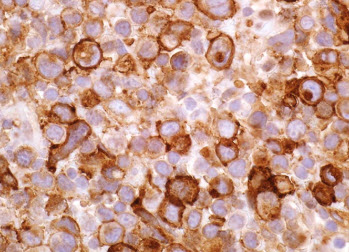 CD25 (4C9) Mouse Monoclonal Antibody