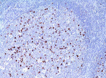 CD57 (NK-1) Mouse Monoclonal Antibody