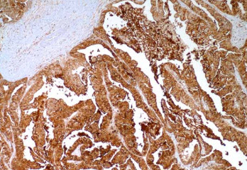 CEA (CEA31) Mouse Monoclonal Antibody