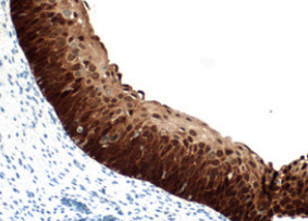 CINtec® p16 Histology, CE-IVD