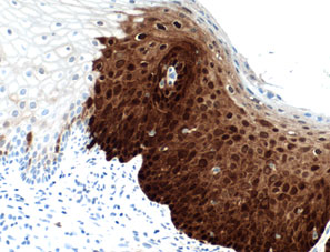 CINtec® Histology Kit, CE-IVD