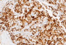 CONFIRM anti-EMA (E29) Mouse Monoclonal Primary Antibody